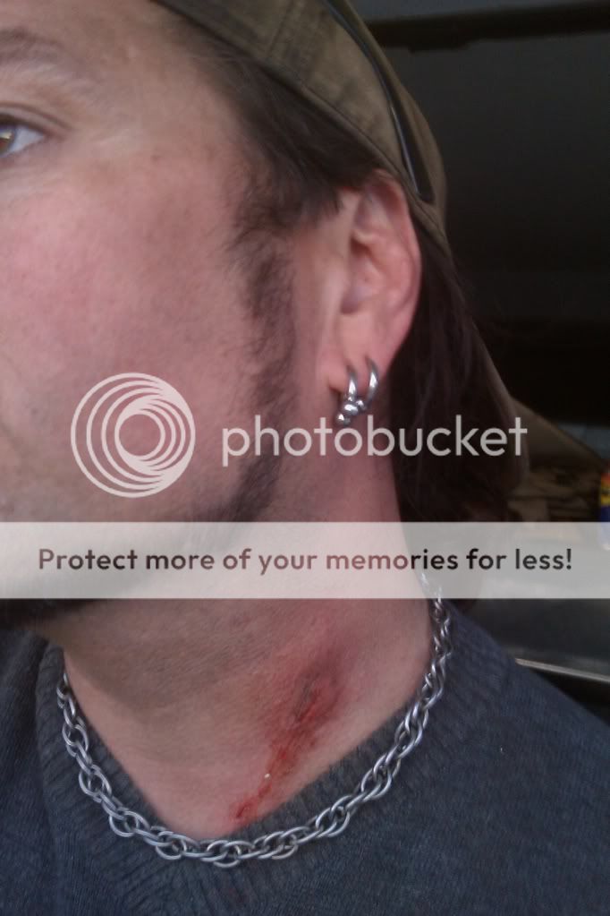 grinder accident | Pirate 4x4